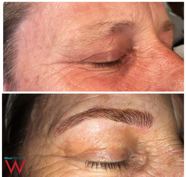 A Guide to Microblading – West Institute | Chevy Chase Dermatology ...