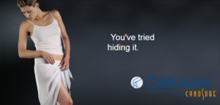 10+ Reasons Why Cellulaze Is the Best Cellulite Reduction Treatment ...